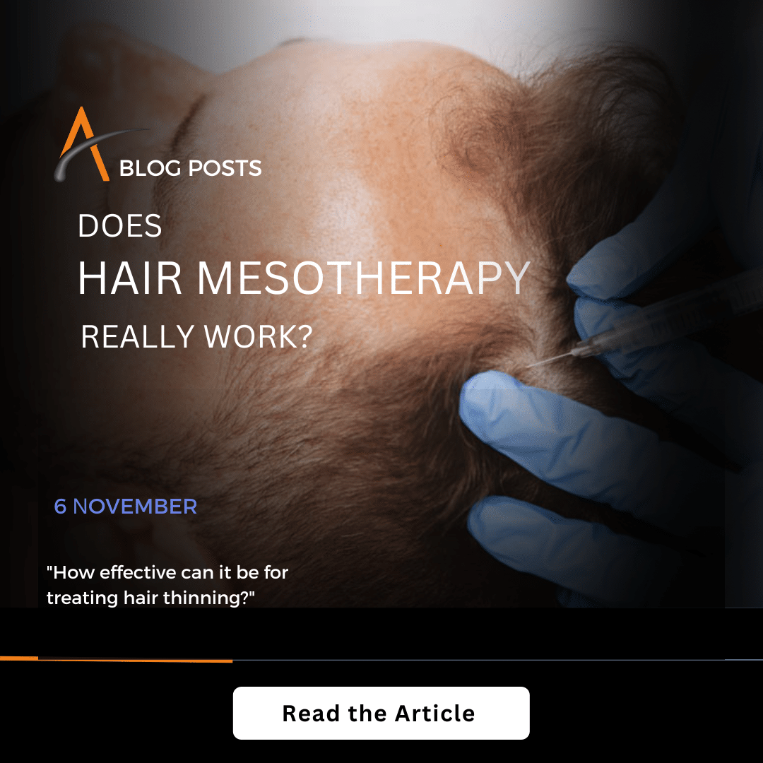 Hair Mesotherapy Benefits, Effectiveness, and PRP Comparison